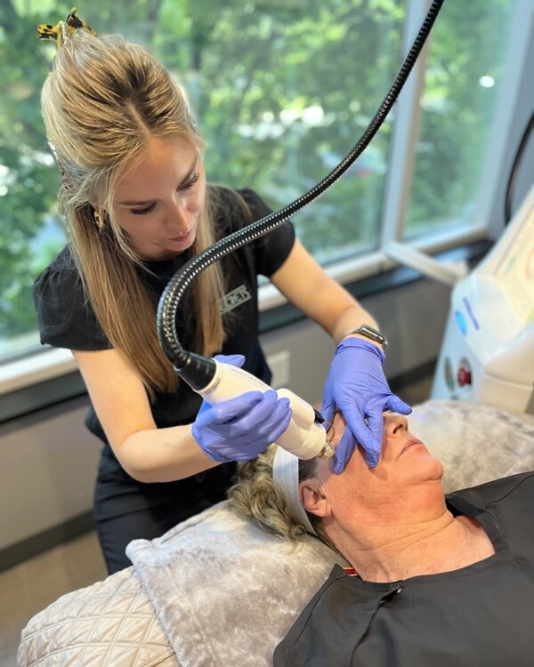 Intracel Radiofrequency Microneedling - Skin Secrets