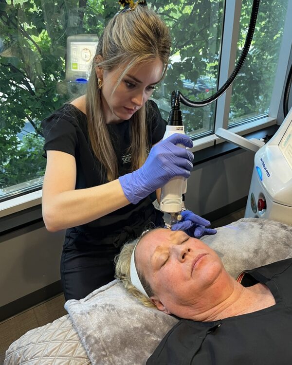 Intracel Radiofrequency Microneedling - Skin Secrets